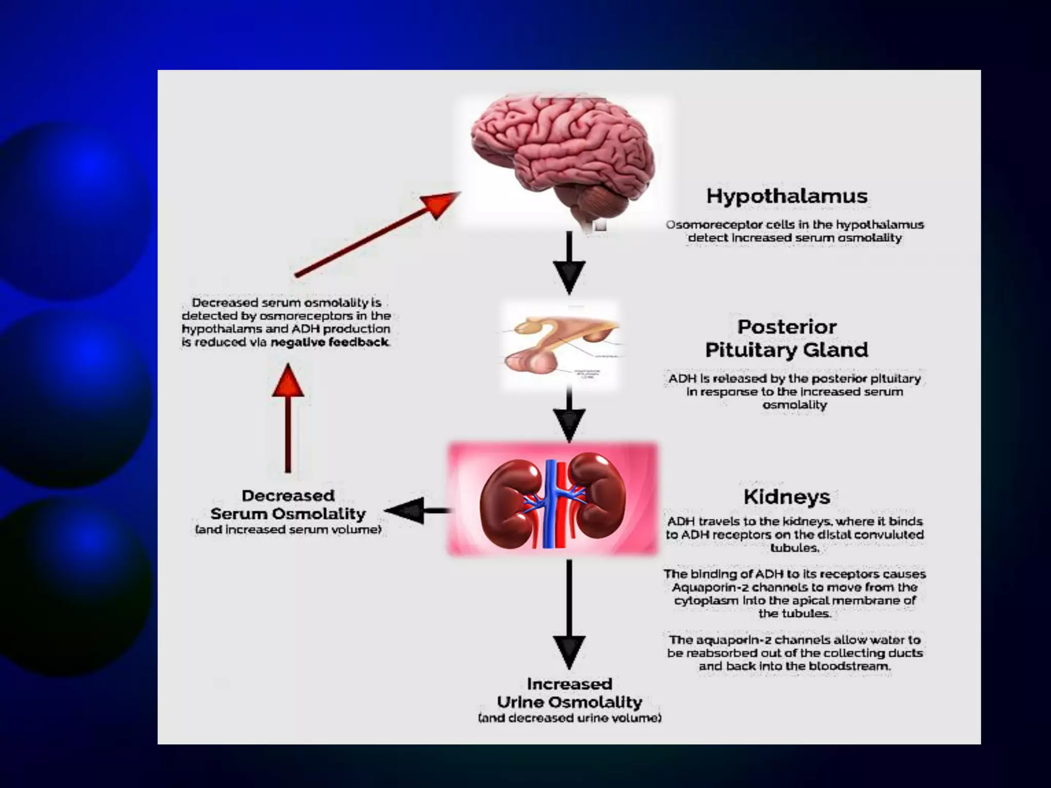 Syndrome of inappropriate antidiuretic hormone secretion (SIADH) | PDF