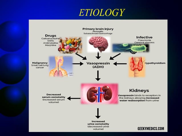 Syndrome of inappropriate antidiuretic hormone secretion (SIADH) | PDF