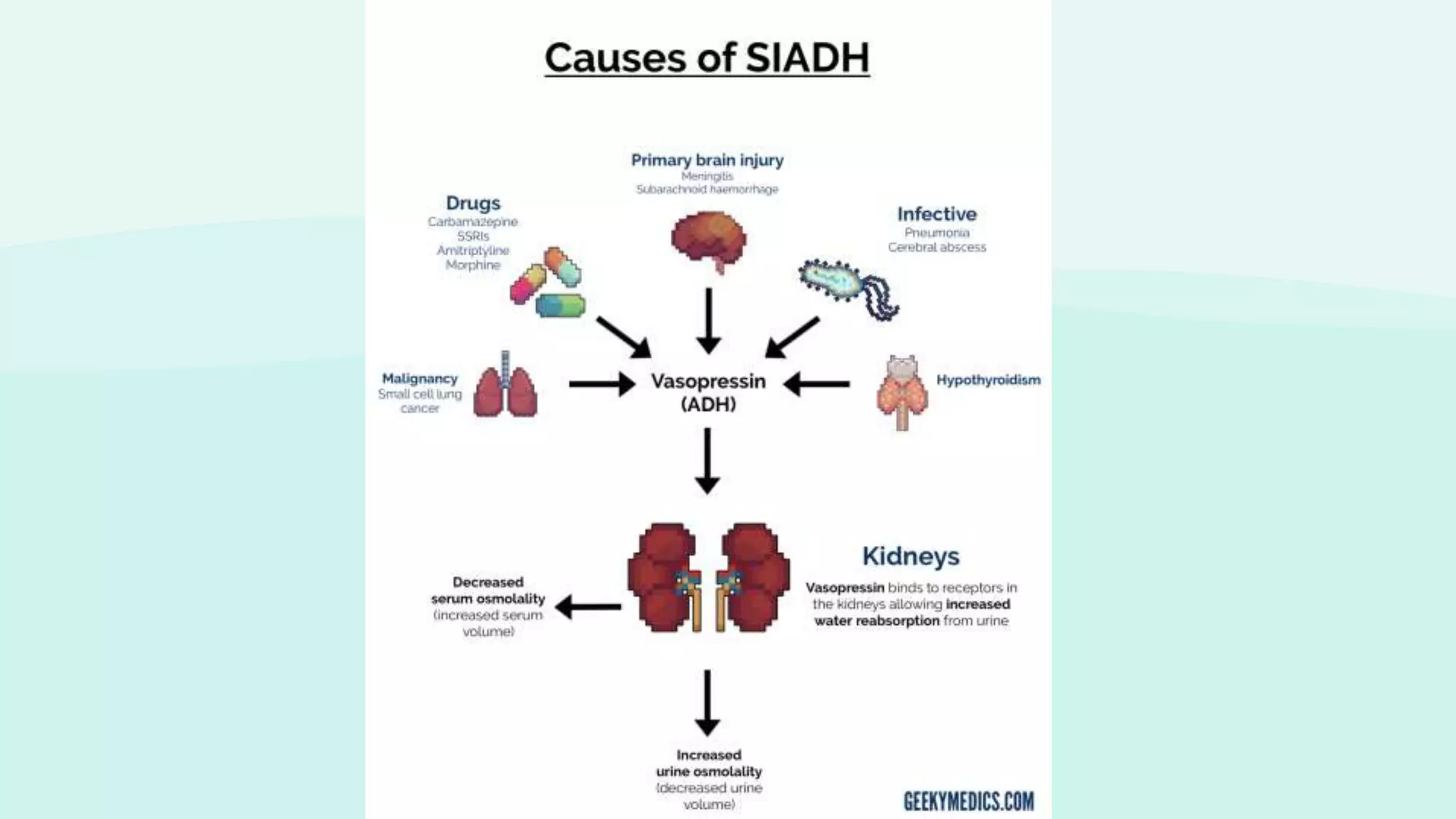 SIADH (Syndrome of inappropriate antidiuretics hormone) | PPTX