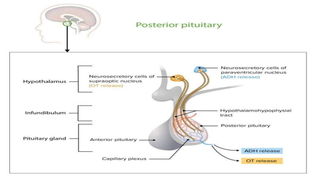 SIADH.pptx | Hormonal Disorders | Endocrine and Metabolic Diseases