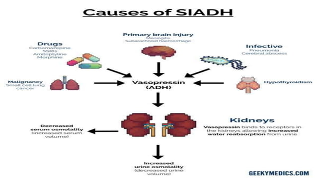 SIADH.pptx | Hormonal Disorders | Endocrine and Metabolic Diseases