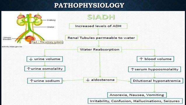 Siadh (1) | PPTX | Hormonal Disorders | Endocrine and Metabolic Diseases