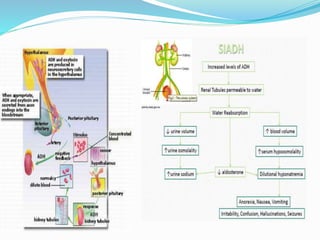 Siadh dr.mumtaz ali | PPTX | Blood Disorders | Diseases and Conditions