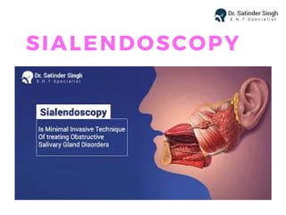 Sialendoscopy | PPT
