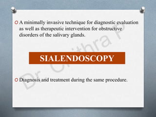 Sialendoscopy dr chithra p | PPT