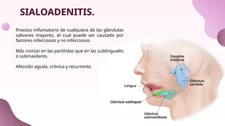 SIALOADENITIS. DIAGNOSTICO, MANEJO Y TRATAMIENTO MEDICO | PPTX