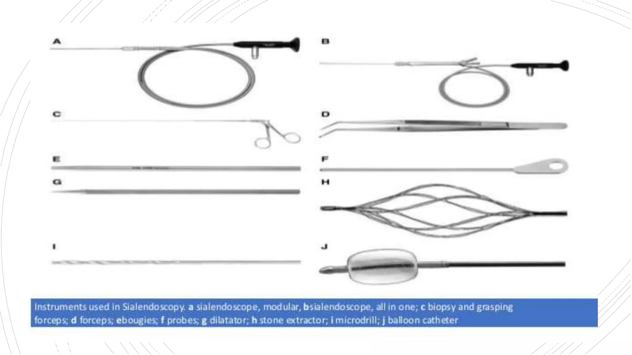 Sialoendoscopy | PPTX