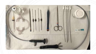 Sialoendoscopy | PPTX