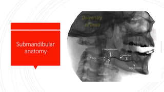 Sialoendoscopy | PPTX