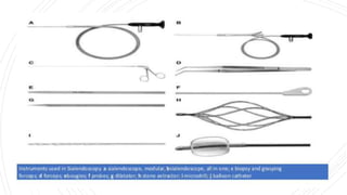 Sialoendoscopy | PPTX