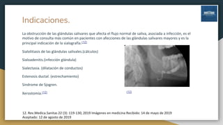 SIALOGRAFIA. DR. GERARDO LARA MALAGON | PPTX