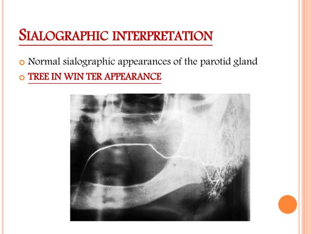 SIALOGRAPHY.pptx | Ear, Nose and Throat Conditions | Diseases and ...