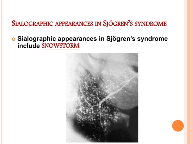 SIALOGRAPHY.pptx | Ear, Nose and Throat Conditions | Diseases and ...