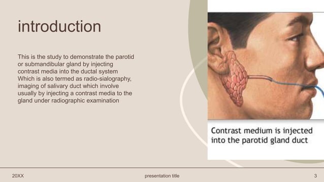 Sialography.pptx | Ear, Nose and Throat Conditions | Diseases and ...