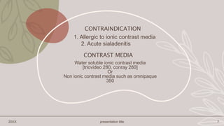 Sialography.pptx