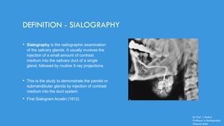 Sialography by Prof j venkat | PDF
