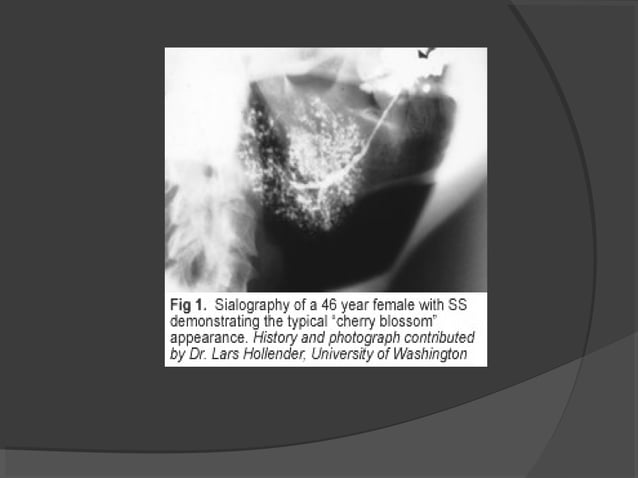Sialography & dacrocystography | PPT | Ear, Nose and Throat Conditions ...