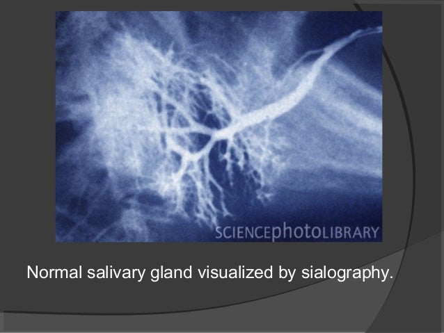 Sialography & dacrocystography