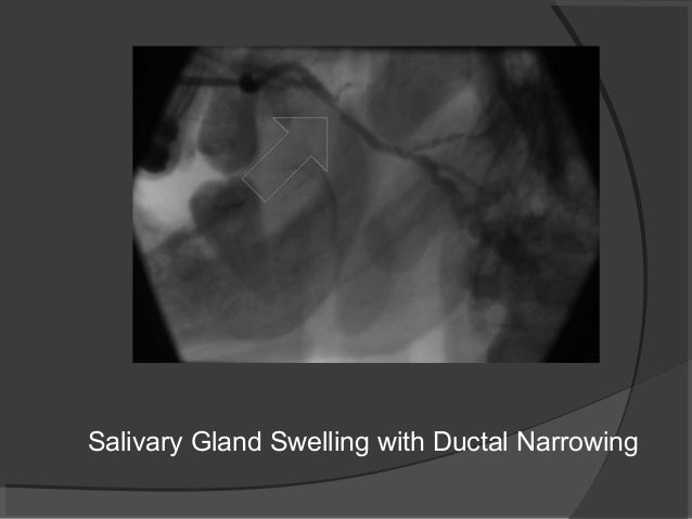 Sialography & dacrocystography