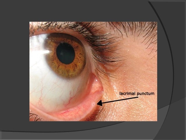 Sialography & dacrocystography