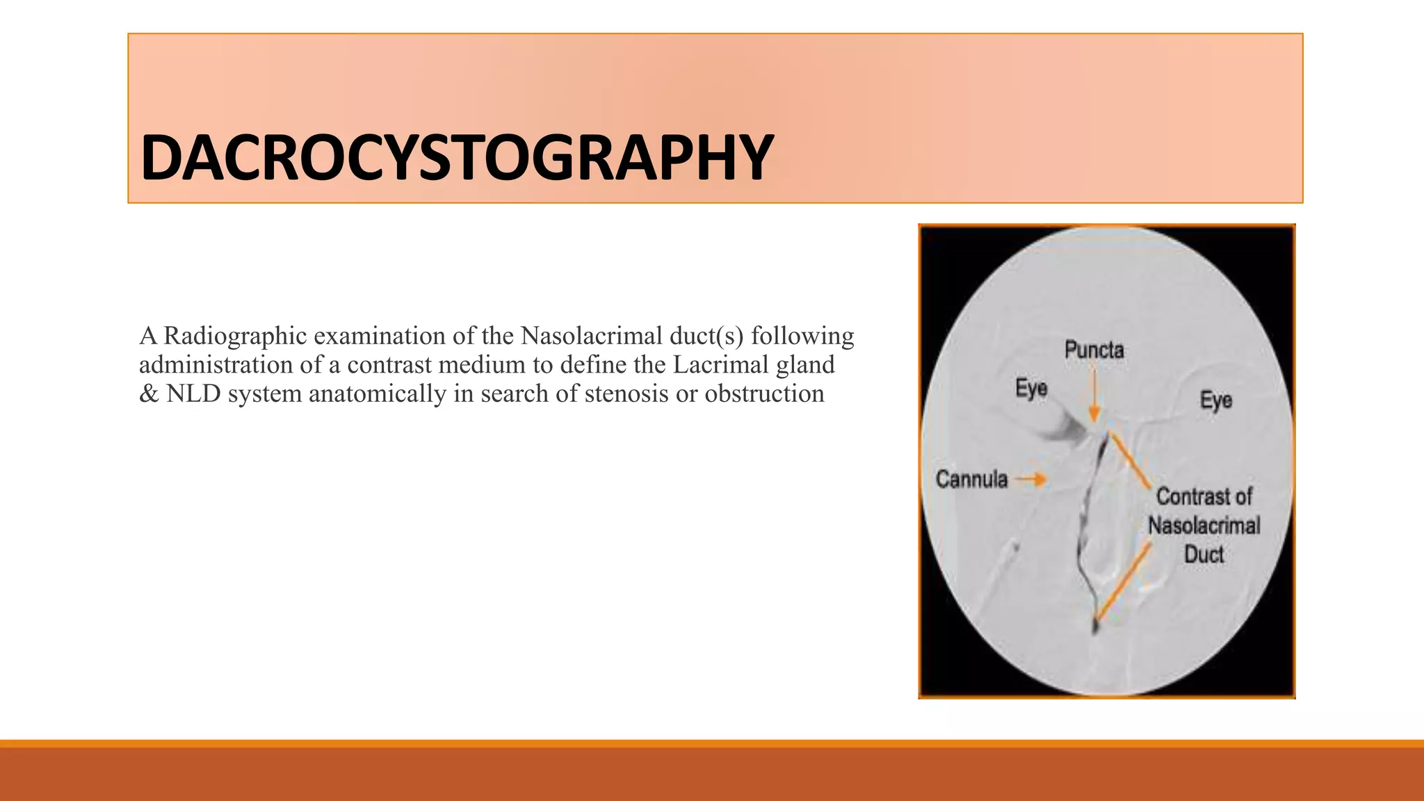 Sialography & Dacrocystography | PPTX
