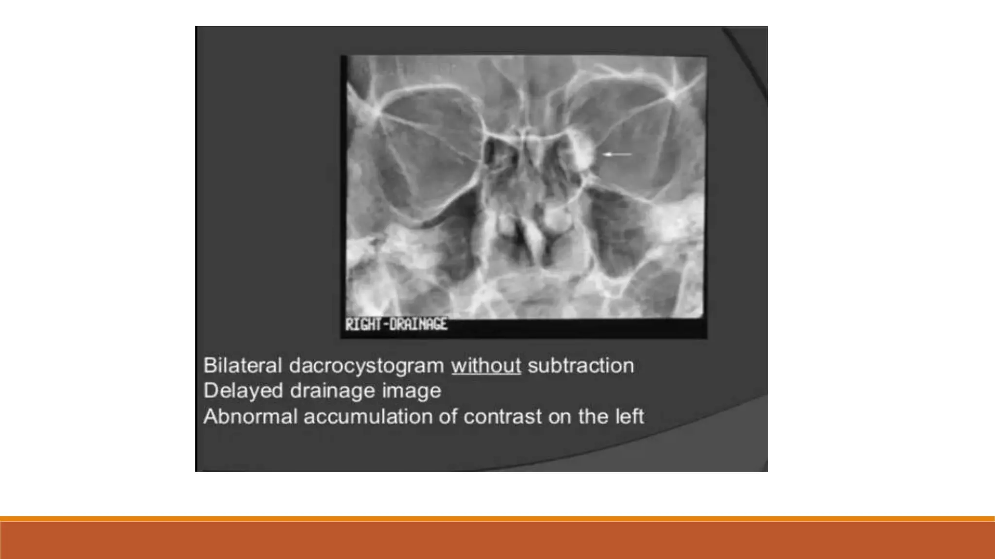 Sialography & Dacrocystography | PPTX