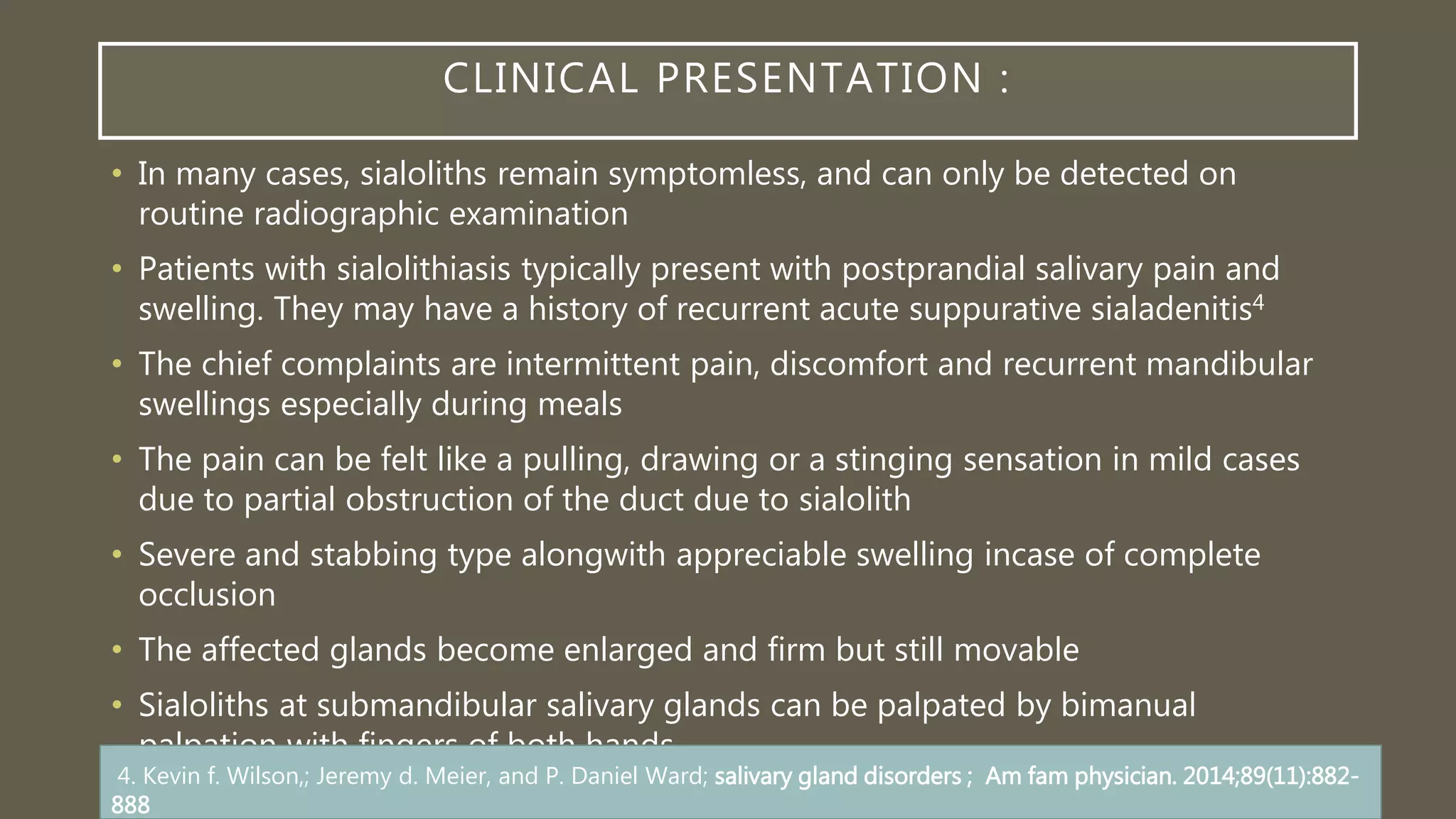 Sialolithiasis | PPTX