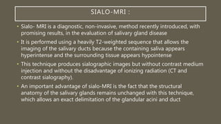 Sialolithiasis | PPTX