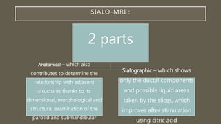 Sialolithiasis | PPTX