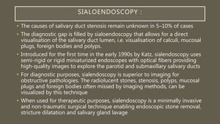 Sialolithiasis | PPTX