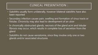 Sialolithiasis | PPTX