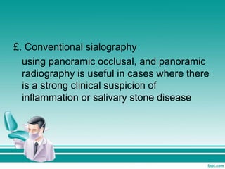 Sialolithiasis (exam oriented presentation) | PPTX