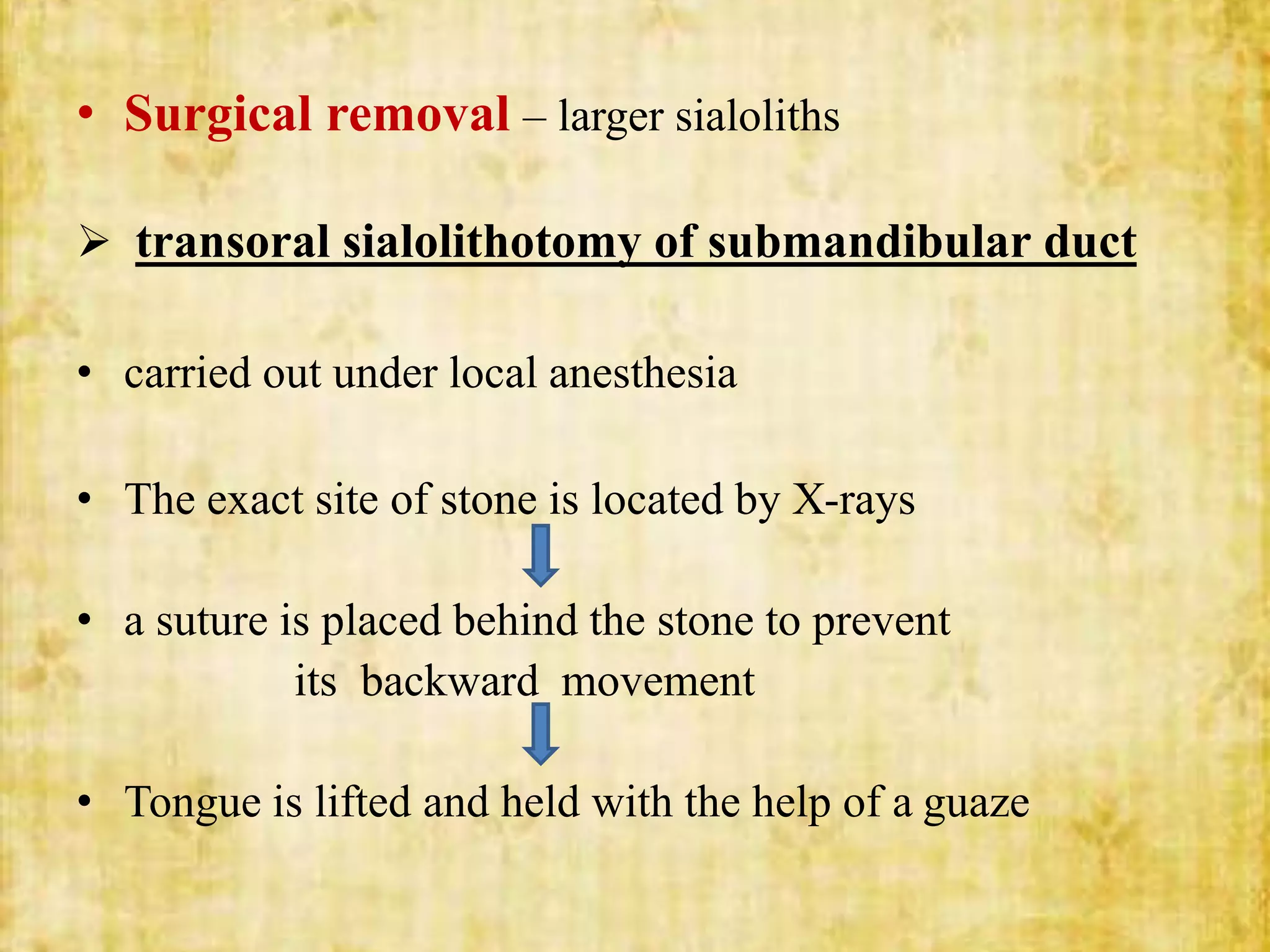 SIALOLITHIASIS - OMFS.pptx