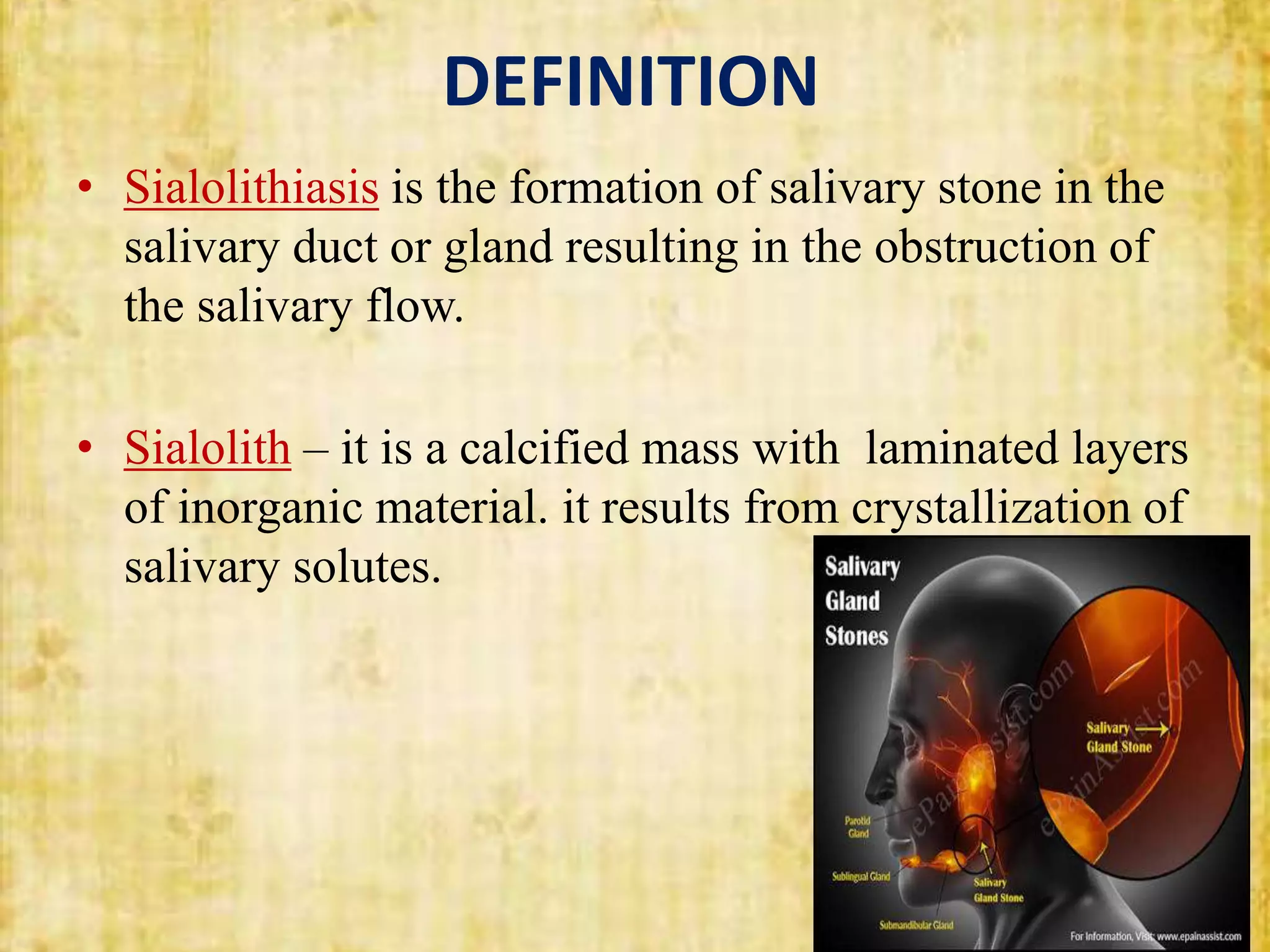 SIALOLITHIASIS - OMFS.pptx