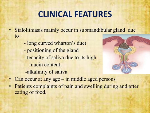 SIALOLITHIASIS - OMFS.pptx | Ear, Nose and Throat Conditions | Diseases ...