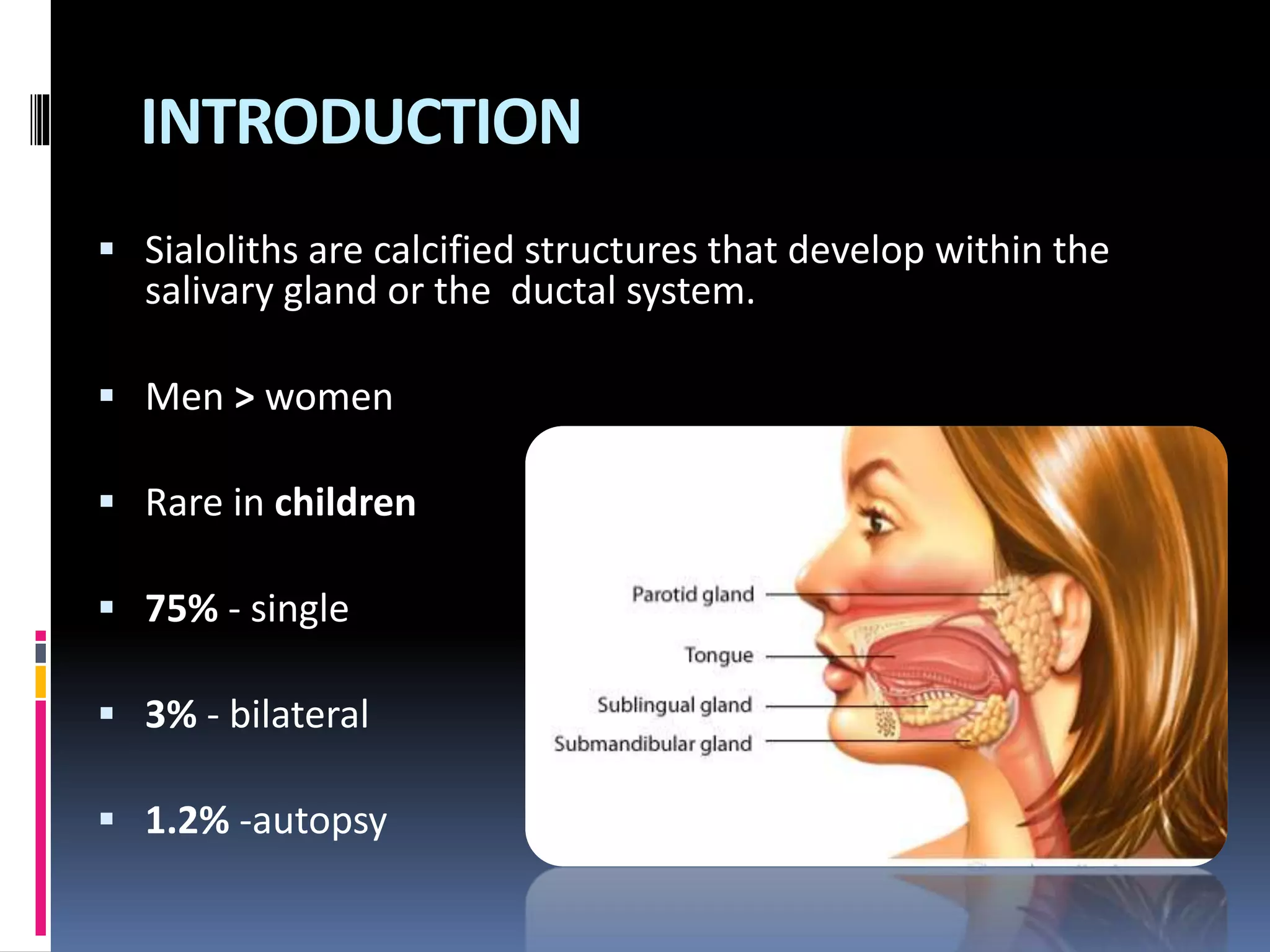 Sialolithiasis and its management in oral and maxillofacial surgery | PPTX