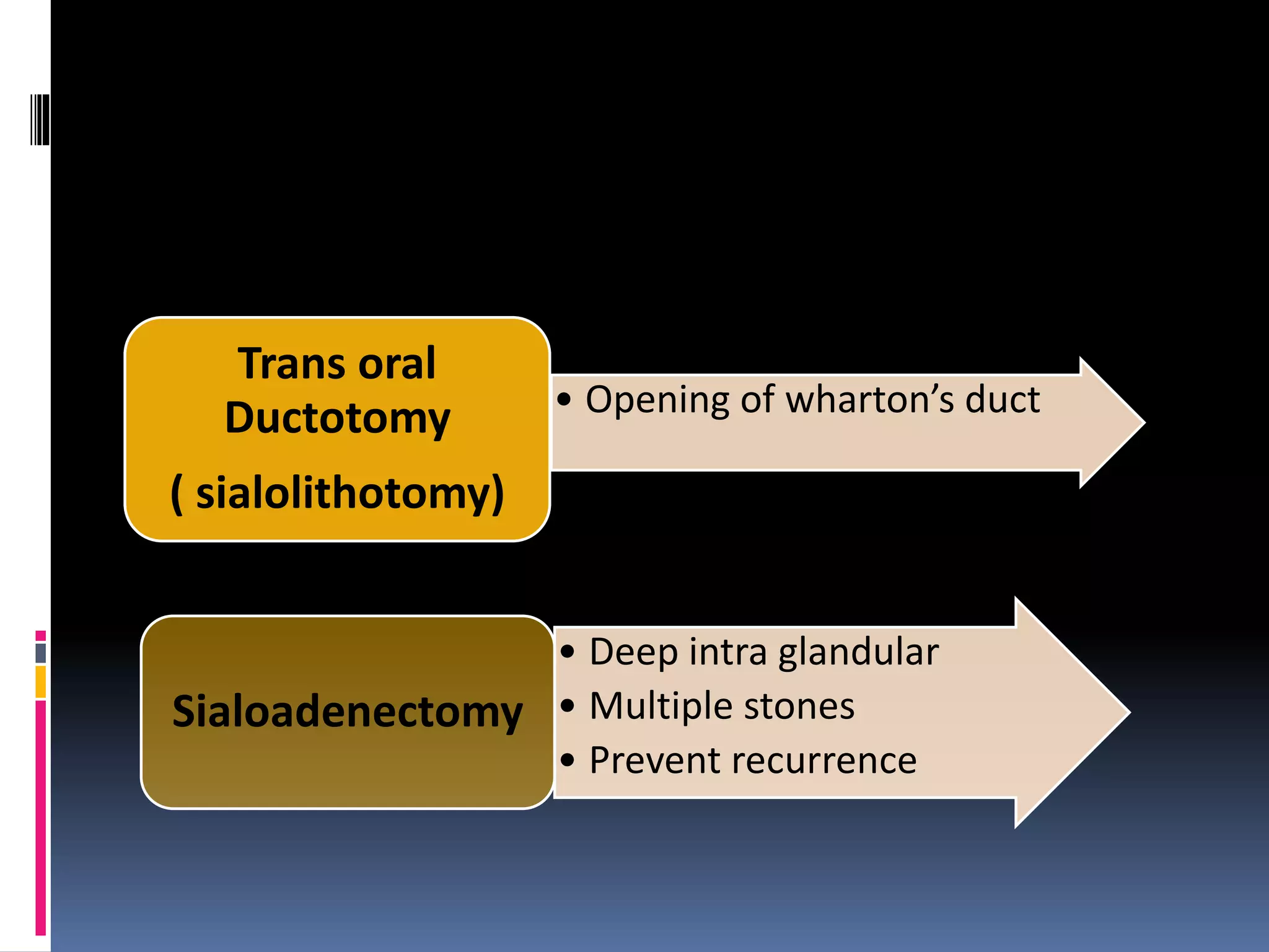 Sialolithiasis and its management in oral and maxillofacial surgery | PPTX