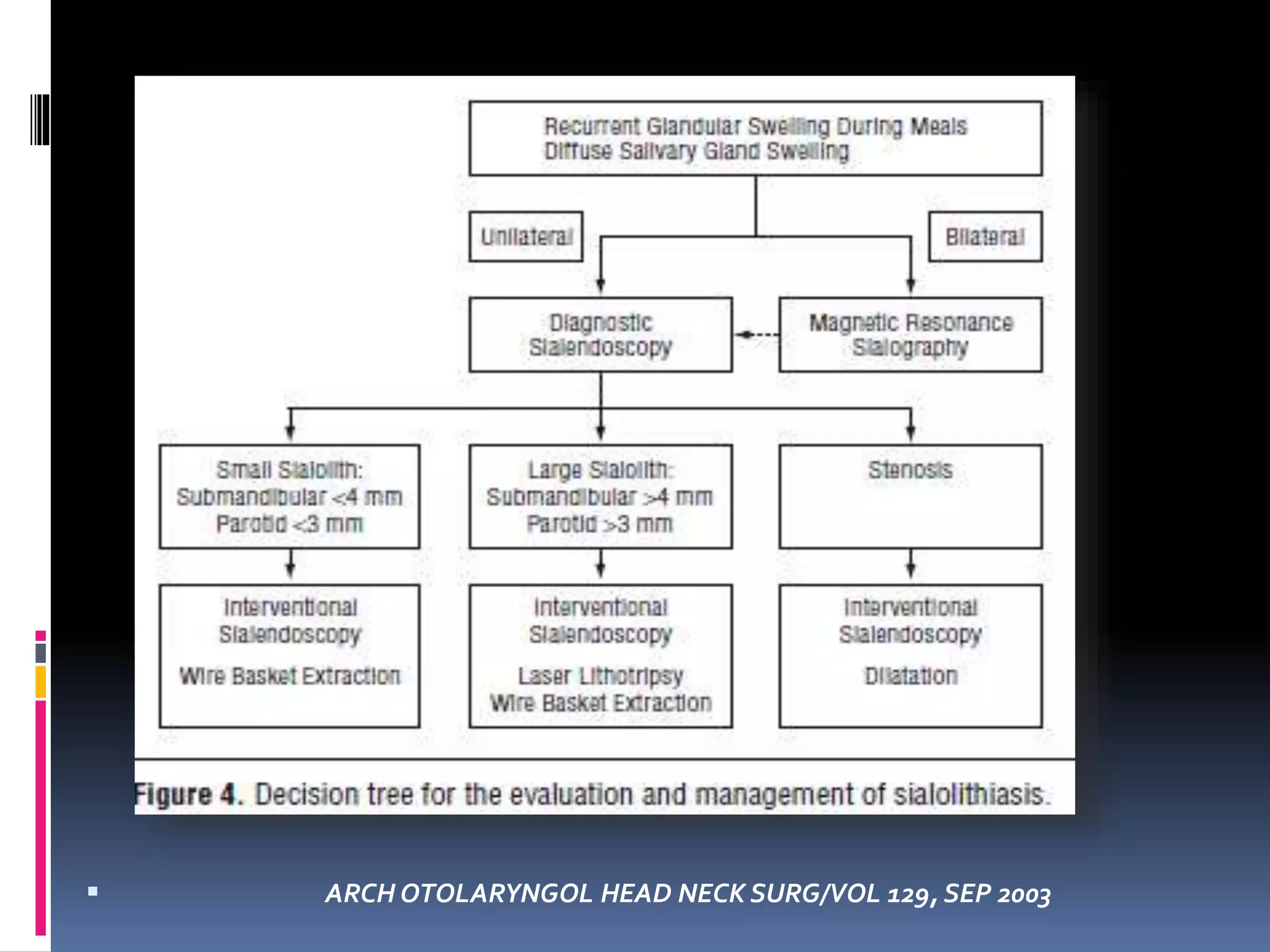 Sialolithiasis and its management in oral and maxillofacial surgery | PPTX