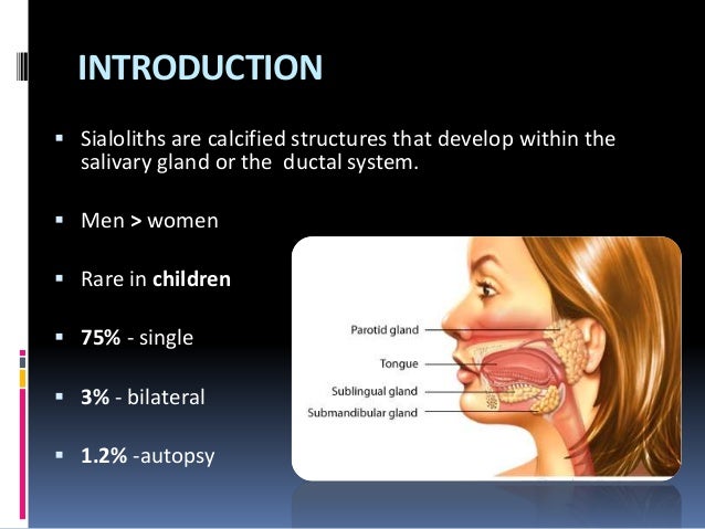 Sialolithiasis and its management in oral and maxillofacial surgery