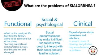 Sialorrhea.pptx