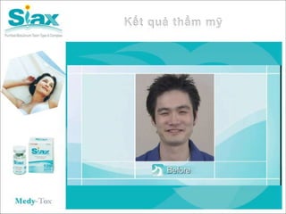 Siax aesthetic | PPT