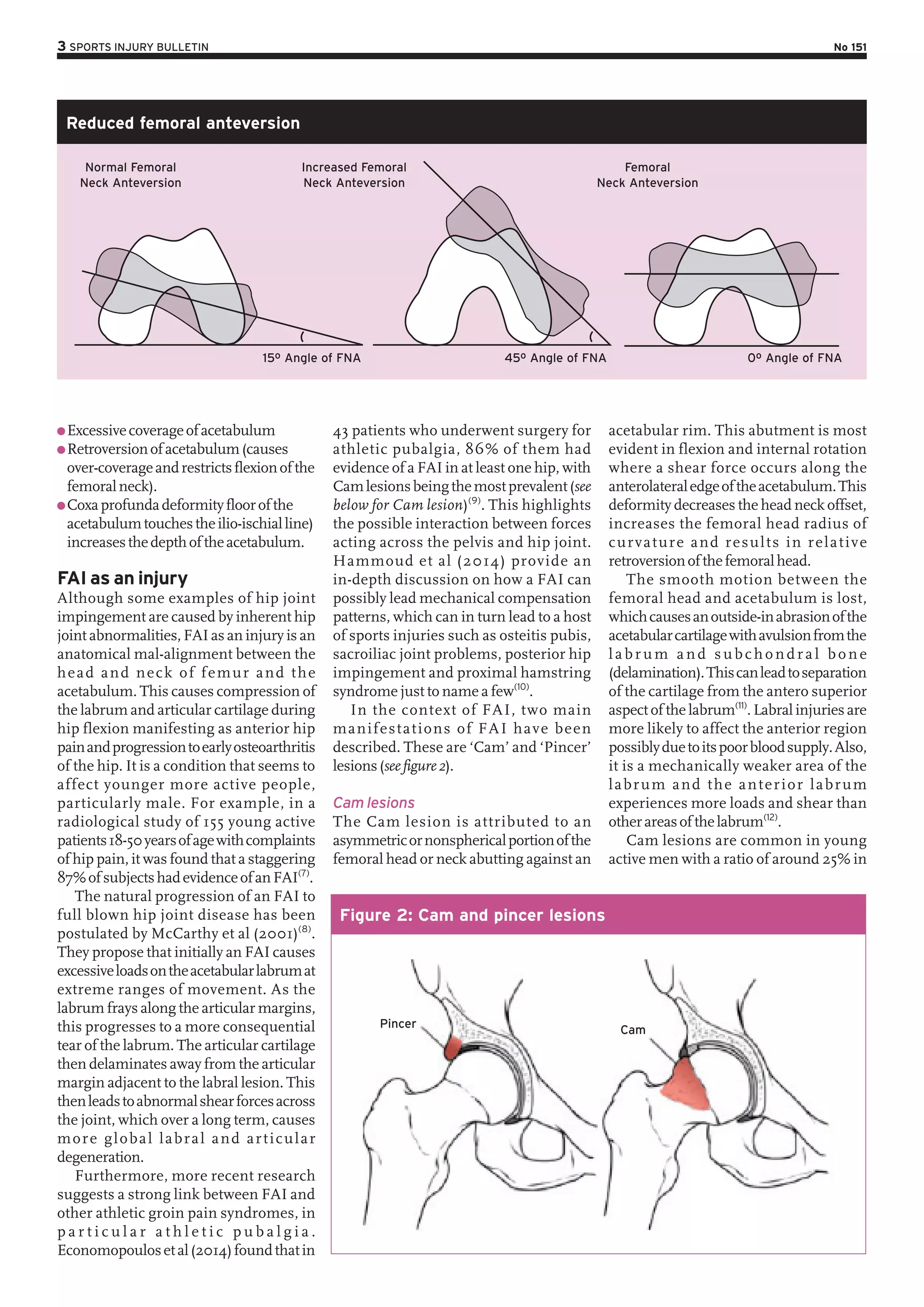 Femoral Acetabular Labral Tear Rehabilitation | PDF
