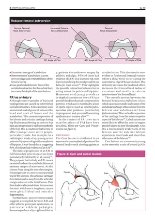 Femoral Acetabular Labral Tear Rehabilitation | PDF | Death, Injury, or ...