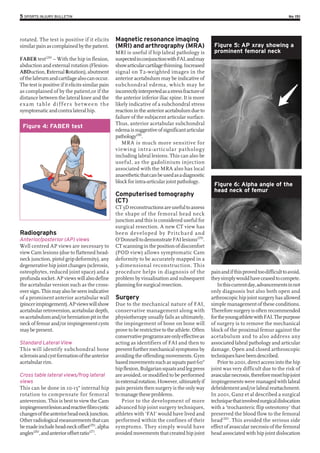 Femoral Acetabular Labral Tear Rehabilitation | PDF | Death, Injury, or ...