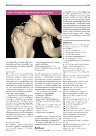 Femoral Acetabular Labral Tear Rehabilitation | PDF | Death, Injury, or ...