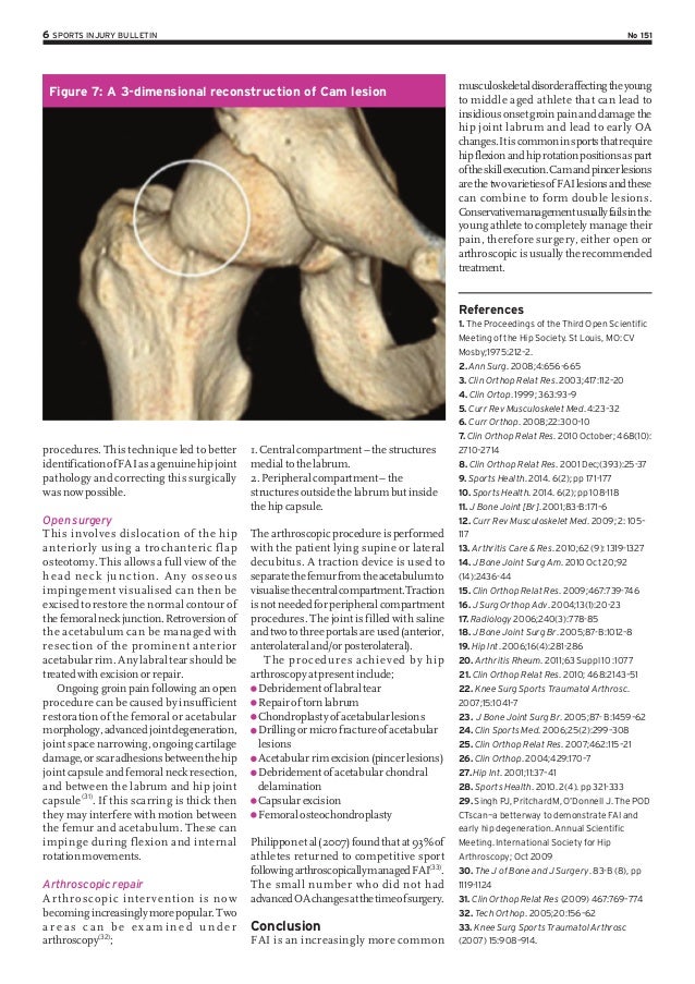Femoral Acetabular Labral Tear Rehabilitation