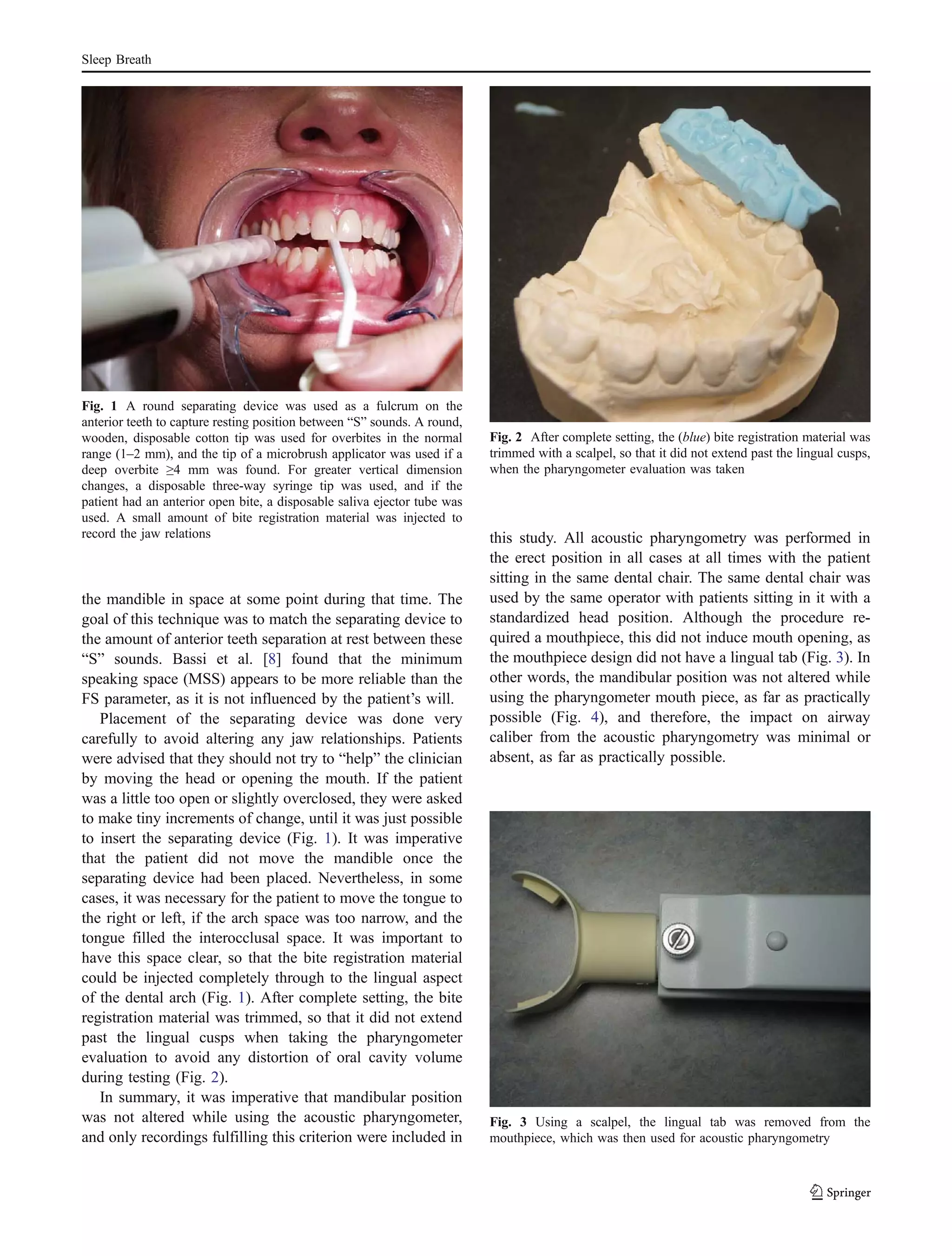Sibilant bite registration olmos singh | PDF