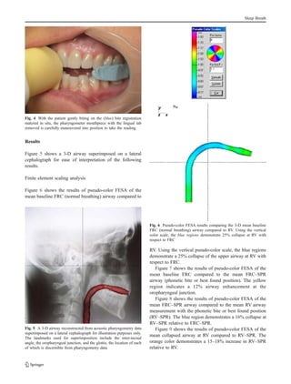 Sibilant bite registration olmos singh | PDF