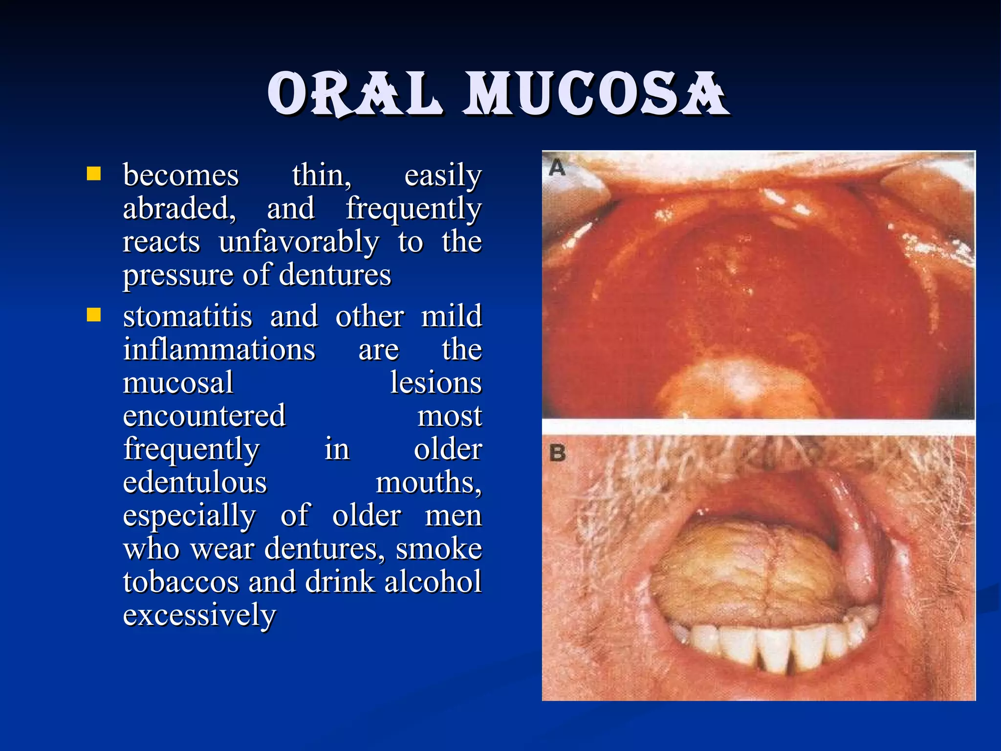 effect of aging on edentulous state | PPT
