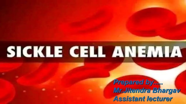 SICKEL CELL ANEMIA Slideshow | PPT